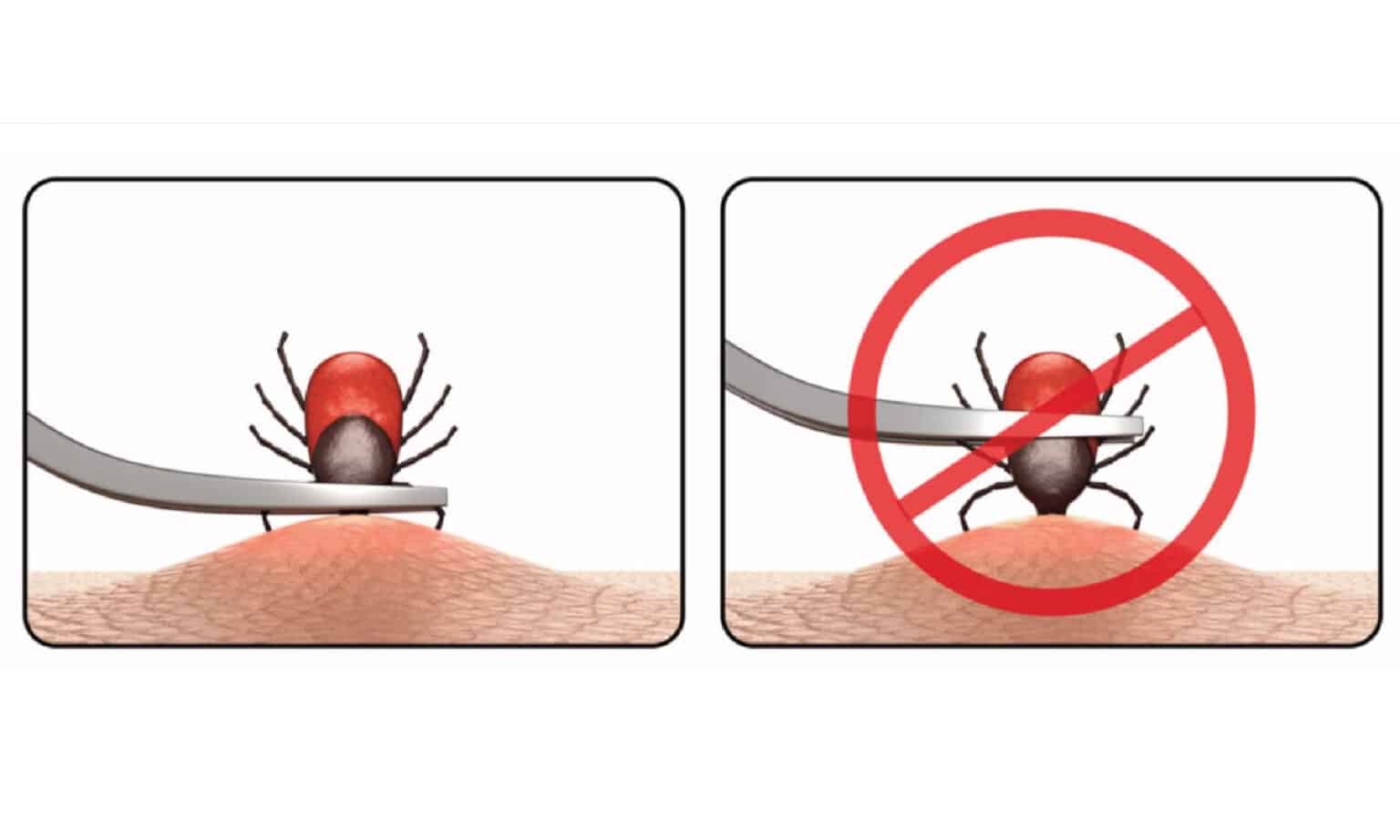 Dried Dead Tick On Dog- How To Remove, What To Do Right Away