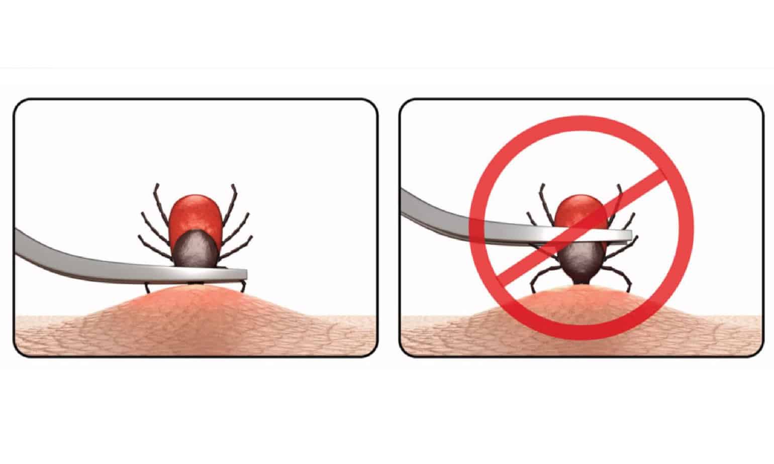 Dried Dead Tick On Dog- How To Remove, What To Do Right Away